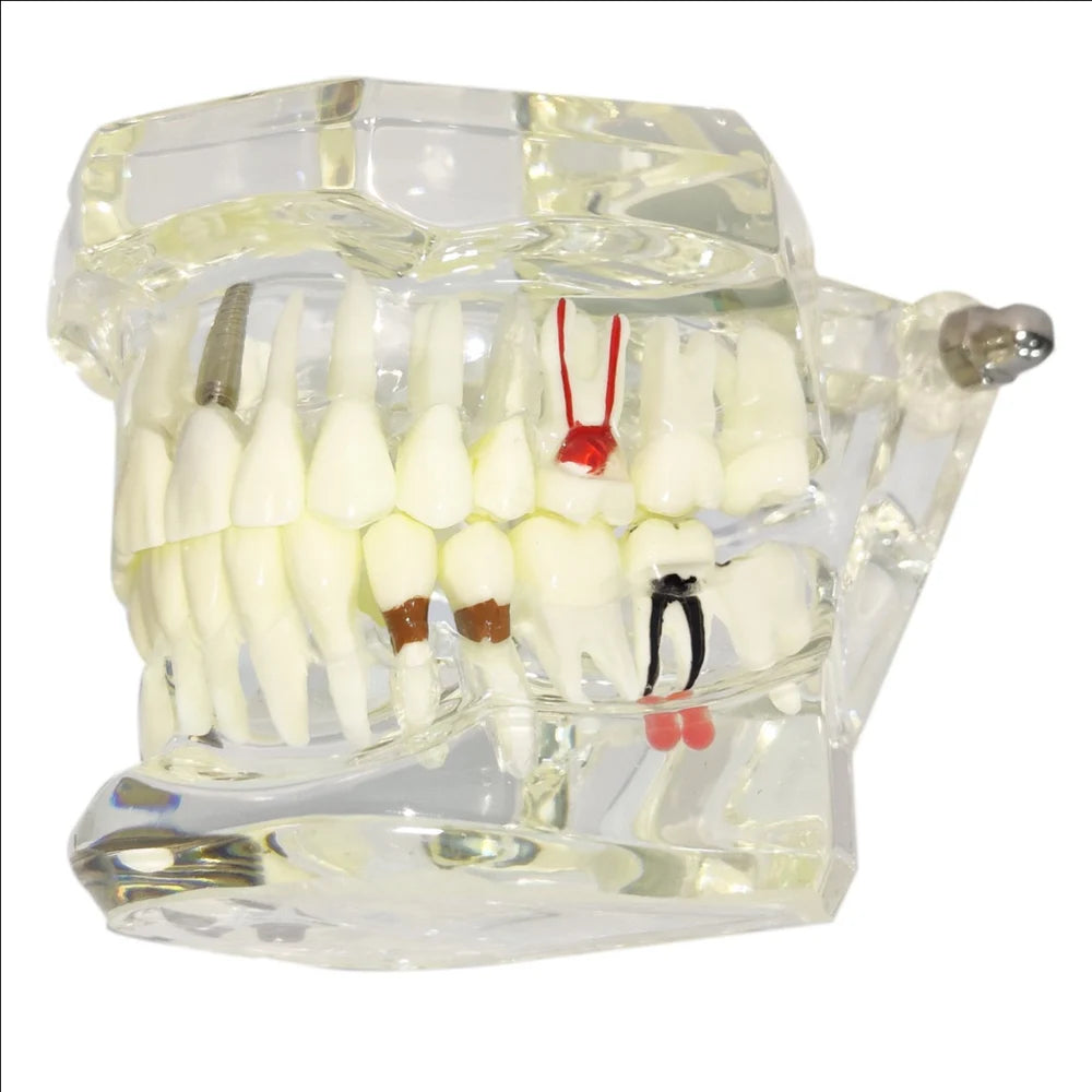 Buy Patient Education Model – Oralkart